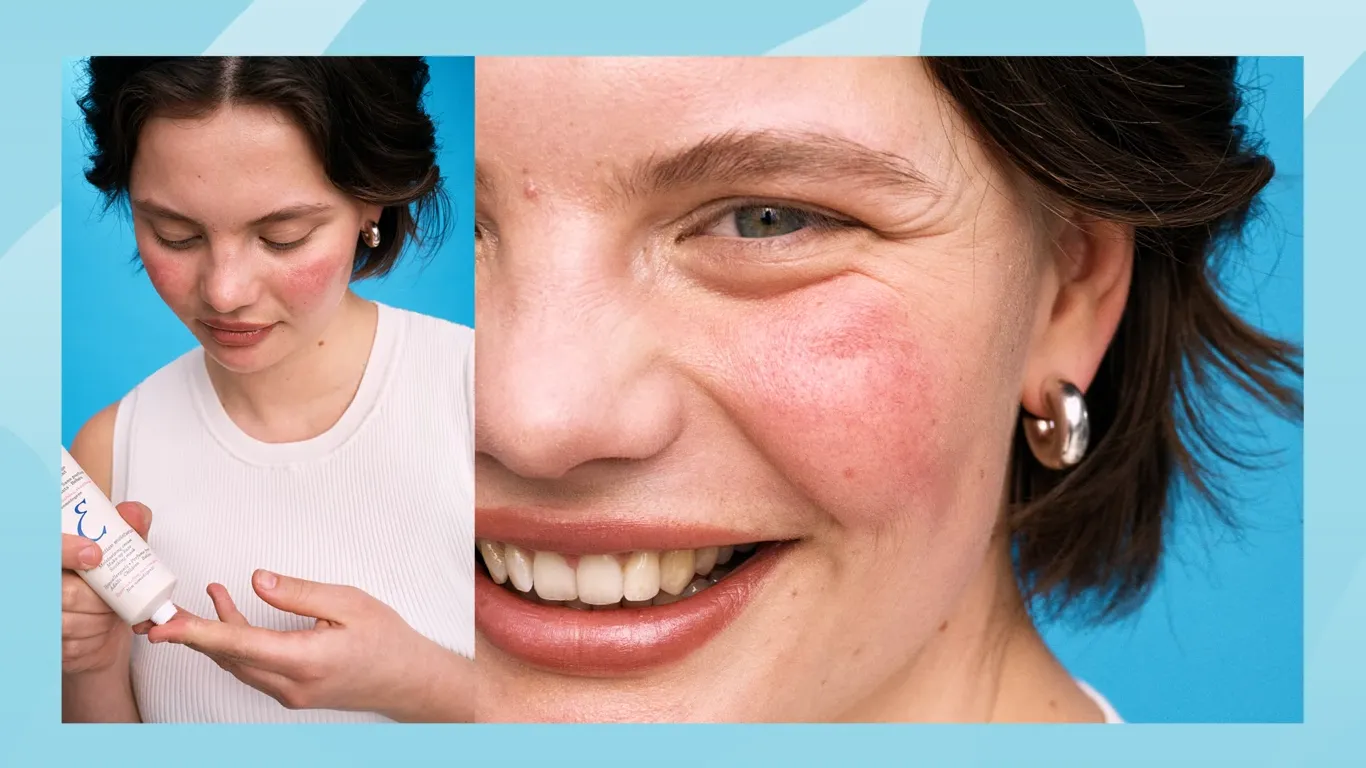 Rodnad på huden – allt du behöver veta - KICKS