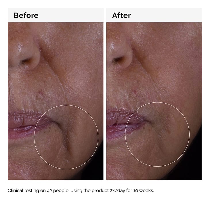 GF 15% Solution Serum 30 ml - The Ordinary - KICKS