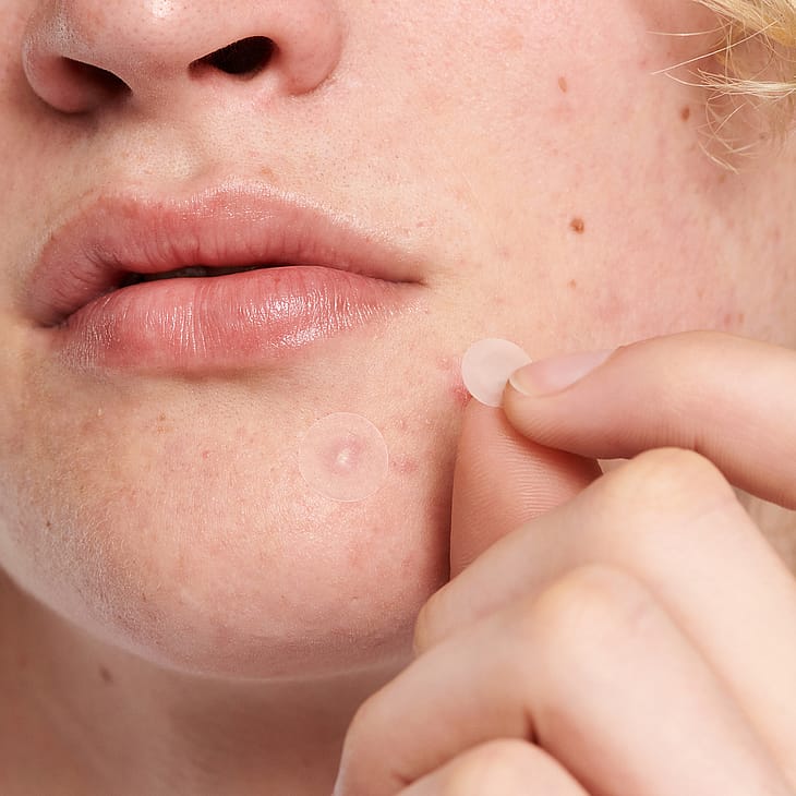 Køb Invisible Pimple Patches fra The INKEY List - Matas