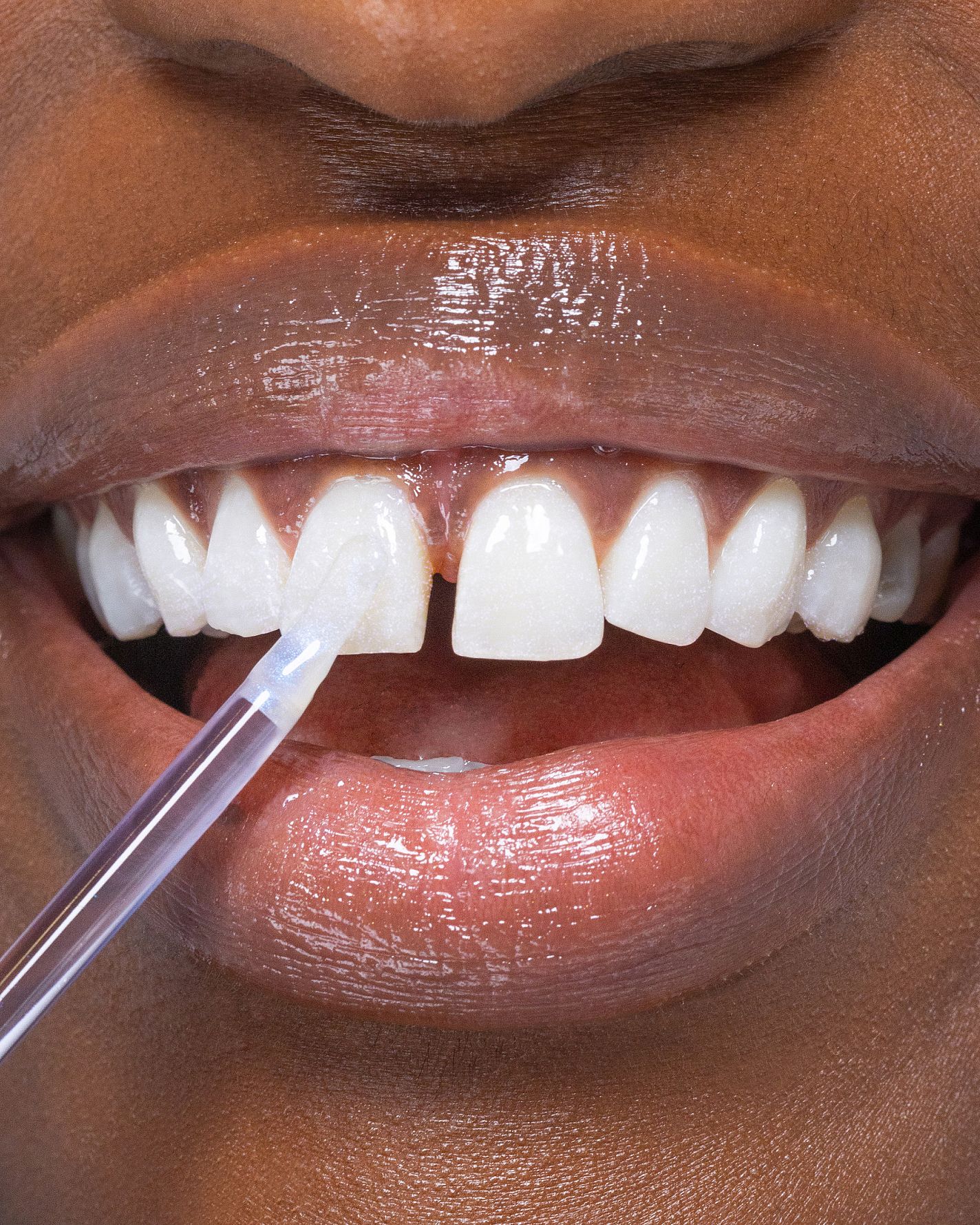 Køb Glostik Tooth Gloss 4 ml fra Hismile - Matas